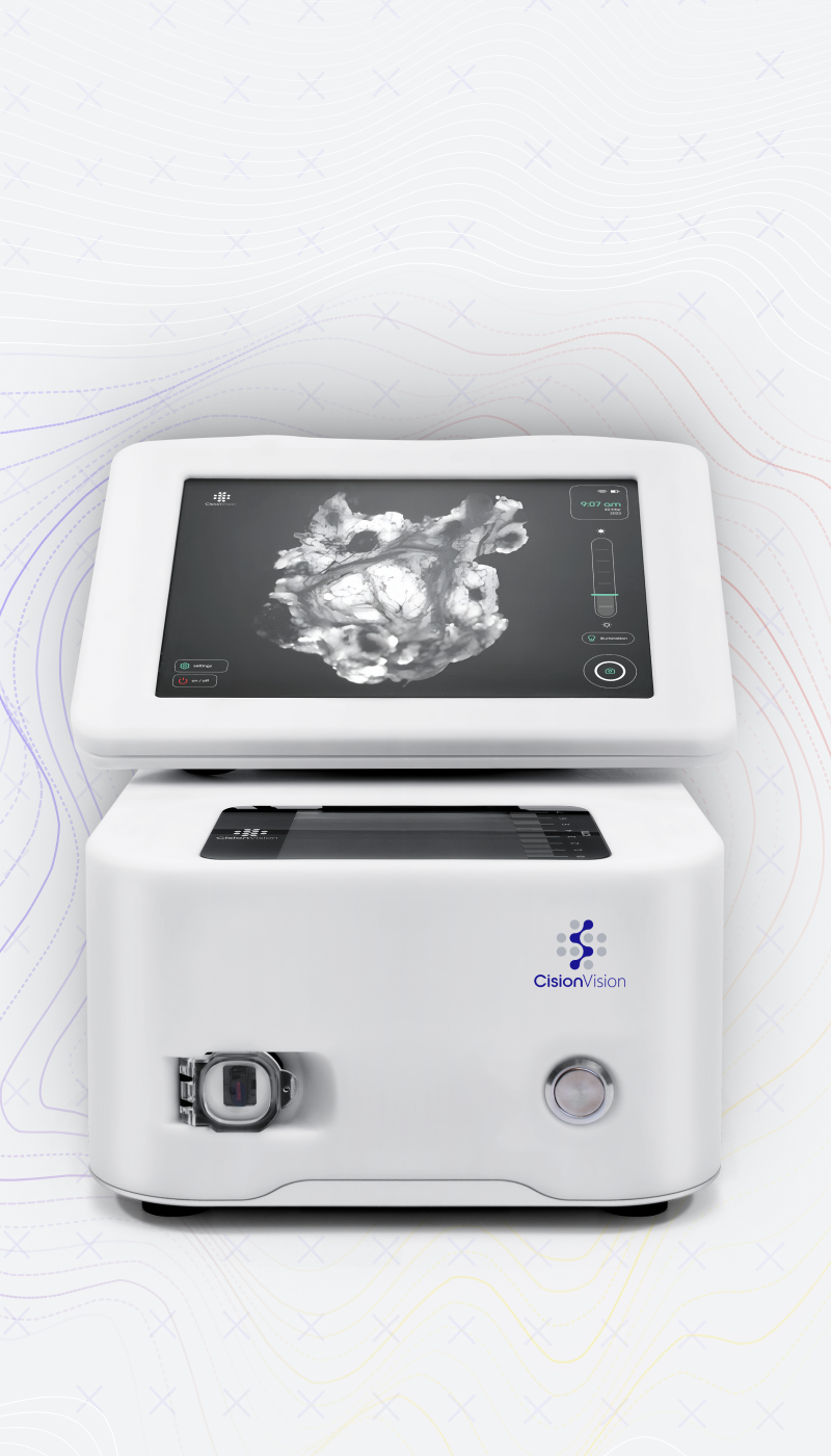 Cision Vision: Lymph Node Grossing Like Never Before