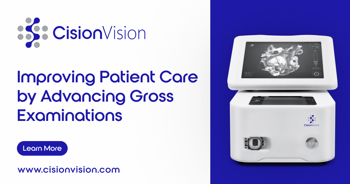 Contact Us - Cision Vision